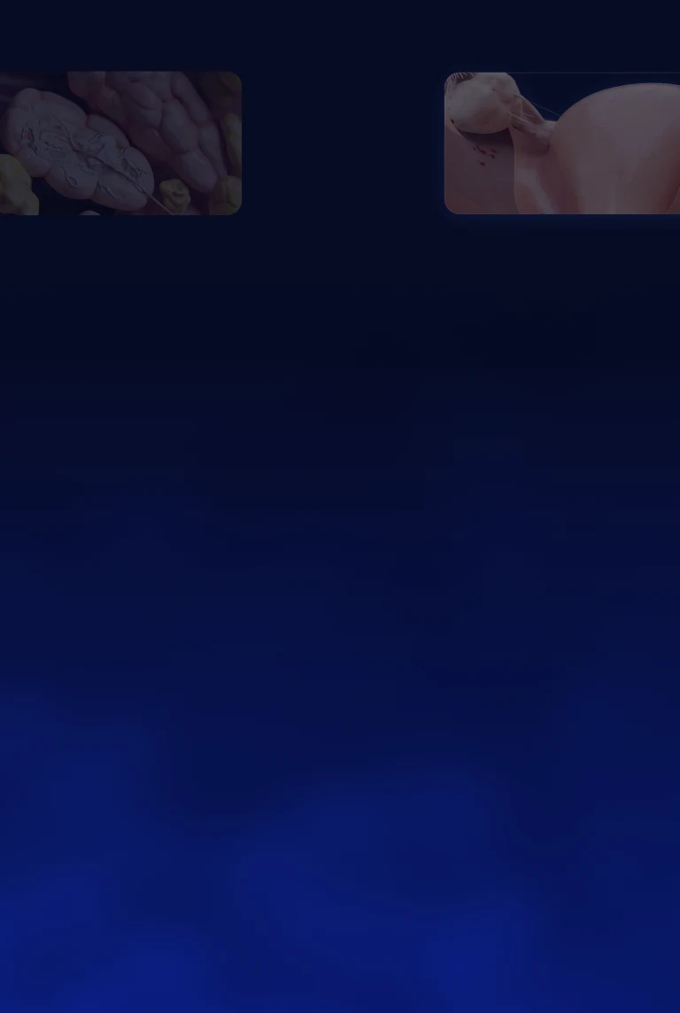 3D Gynecology Animation Services | VOKA